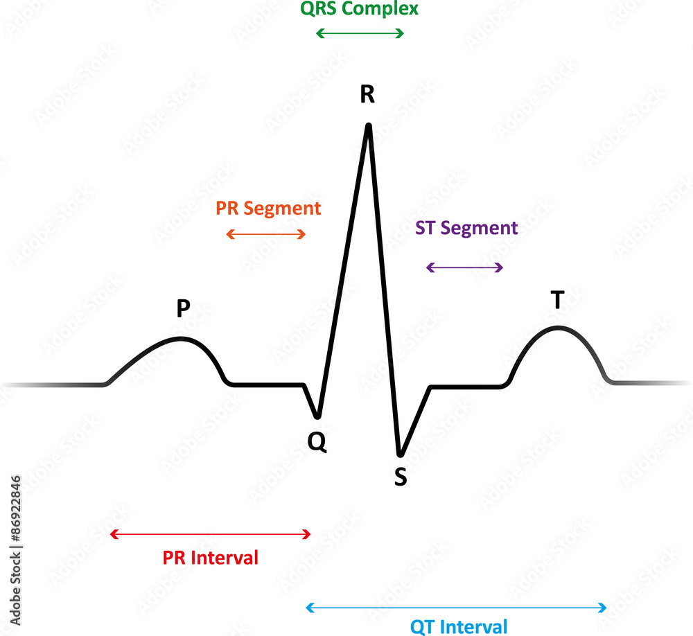 ECG Waveform vector de Stock | Adobe Stock