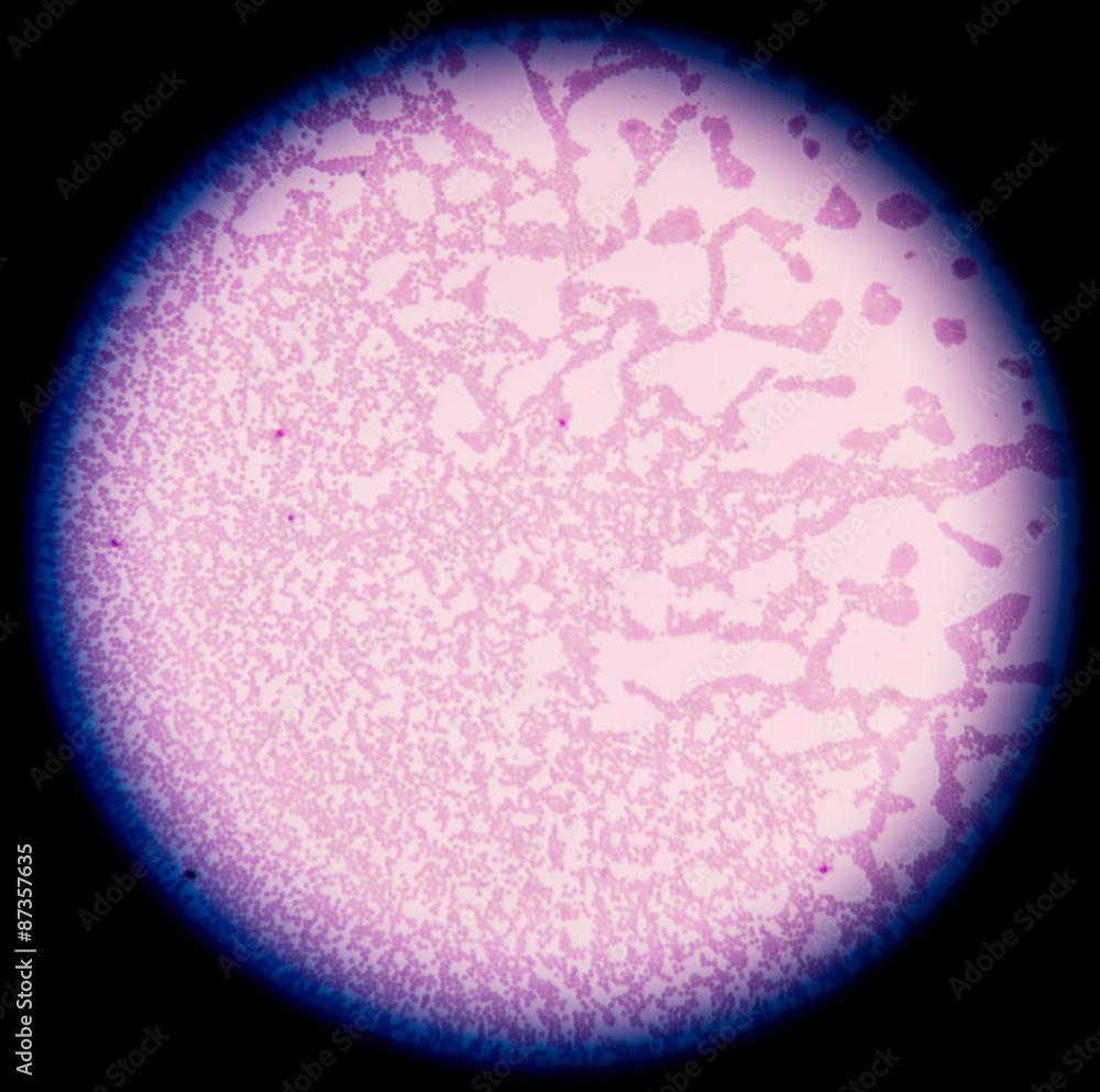 White blood cells of a human, photomicrograph panorama as seen u Stock ...