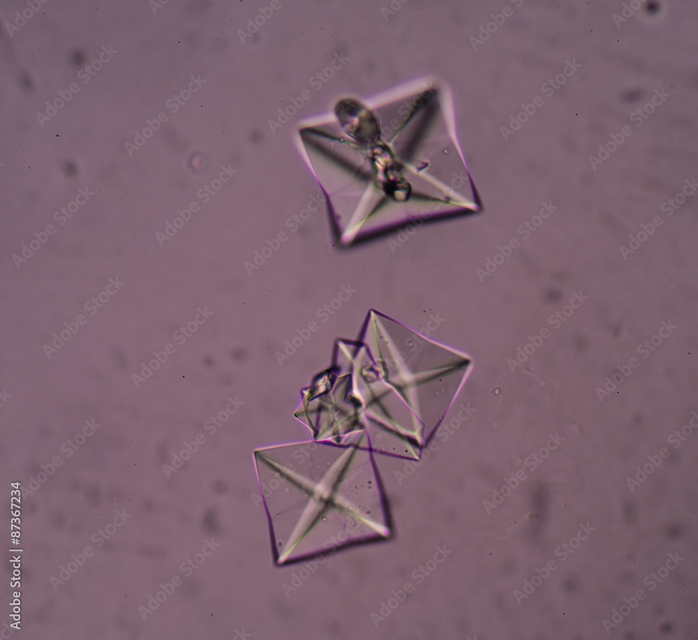 calcium oxalate crystal in urine analysis. Stock Photo | Adobe Stock