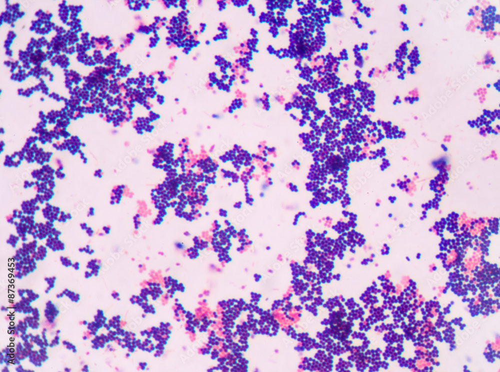 Gram staining, also called Gram's method, is a method of differe Stock ...