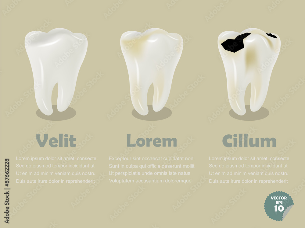 set of realistic tooth including healthy tooth and decayed tooth ...