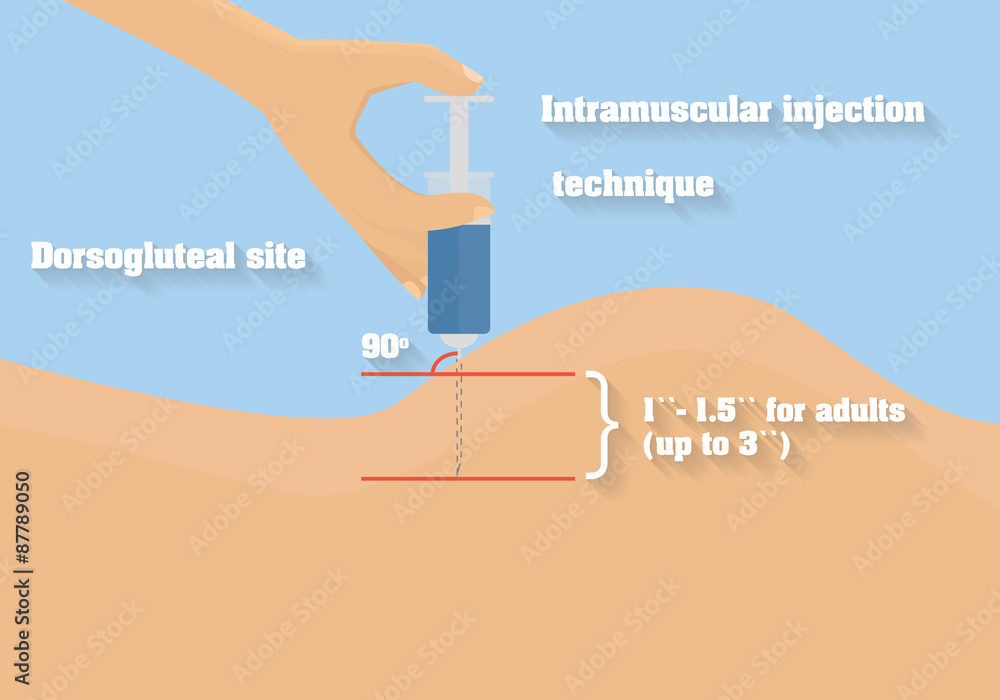 Intramuscular Injection And Subcutaneous Injection St - vrogue.co Intramuscular Injection And Subcutaneous Injection St - vrogue.co