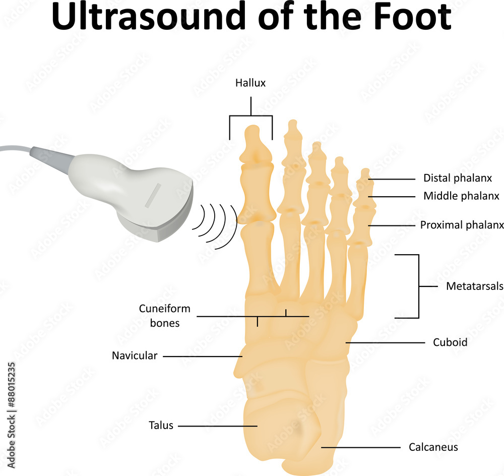 Ultrasound of the Foot Stock Illustration | Adobe Stock