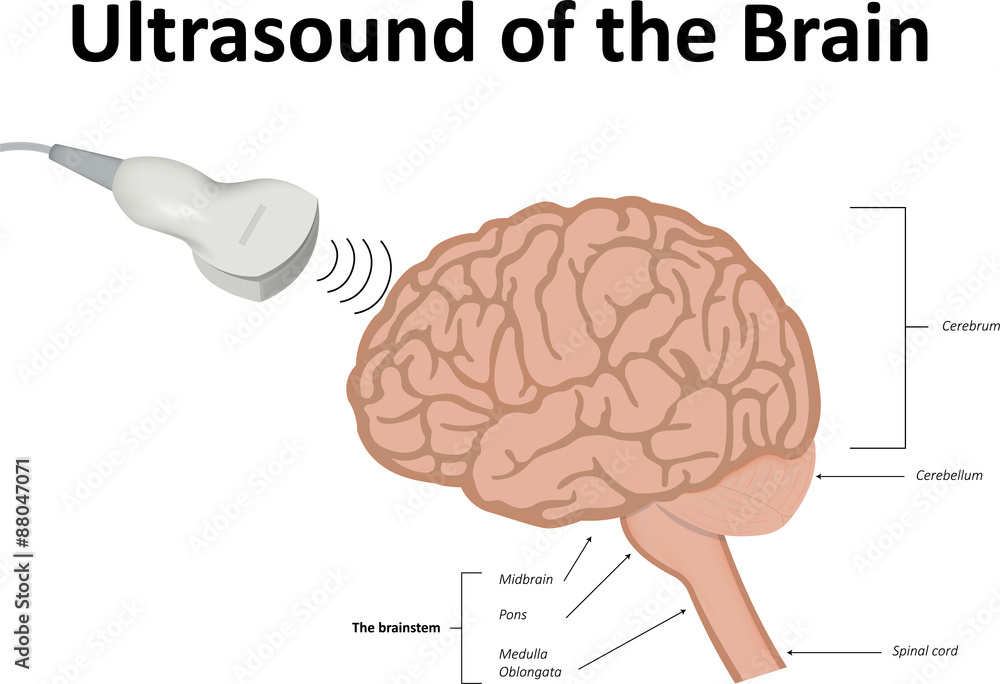 Ultrasound of the Brain Stock Illustration | Adobe Stock