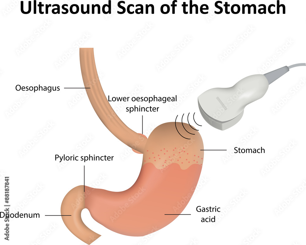 Ultrasound Scan of the Stomach Stock Vector | Adobe Stock
