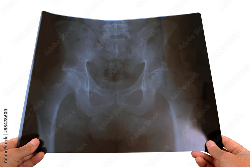 Examen de la radiographie du bassin Stock Photo | Adobe Stock