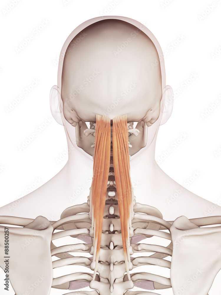medically accurate muscle illustration of the semispinalis capitis ...