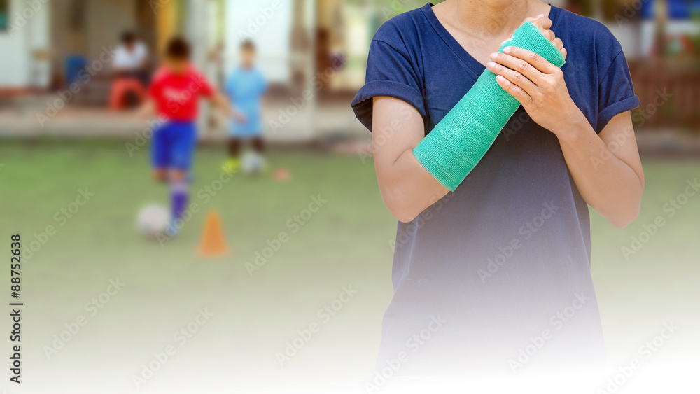 broken arm with green cast on blurred background kid soccer play Stock ...