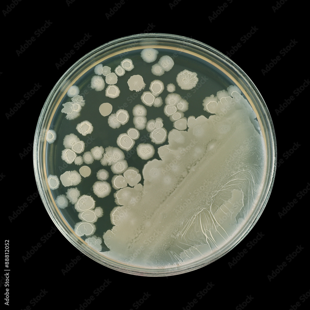 Bacterial colonies on petri dish plate isolated on a black background ...
