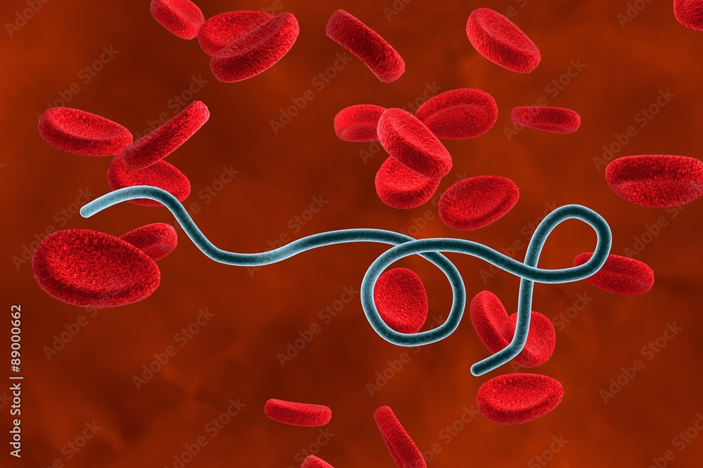 Three-dimensional drawing of Borrelia bacteria in blood with red blood ...