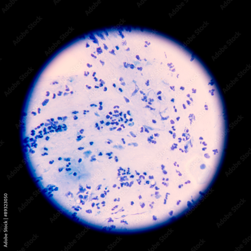 Slide Sputum AFB Negative Find With Microscope Stock Photo Adobe Stock slide-sputum-afb-negative-find-with-microscope-stock-photo-adobe-stock