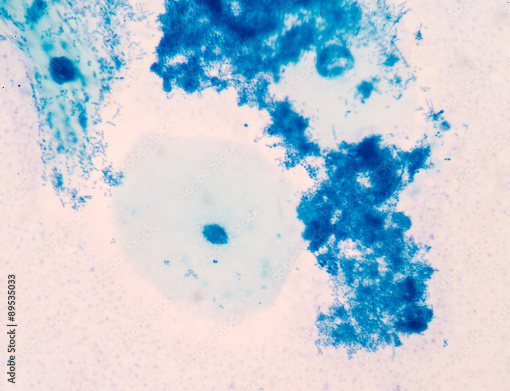 Blue squamous cell with bacteria. Stock Photo | Adobe Stock