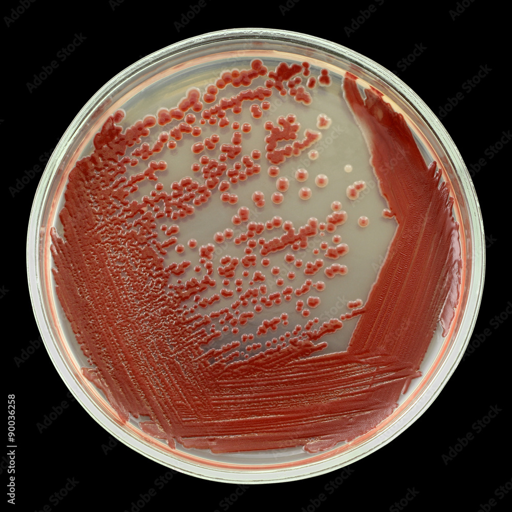 Red bacterial colonies on a petri plate ( dish ) isolated on a black ...