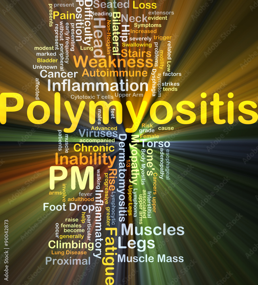 Polymyositis PM background concept glowing Stock Illustration | Adobe Stock