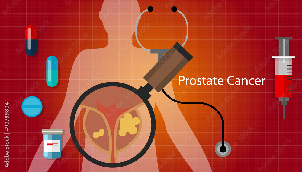 prostate cancer health medical illustration medication cure Stock ...