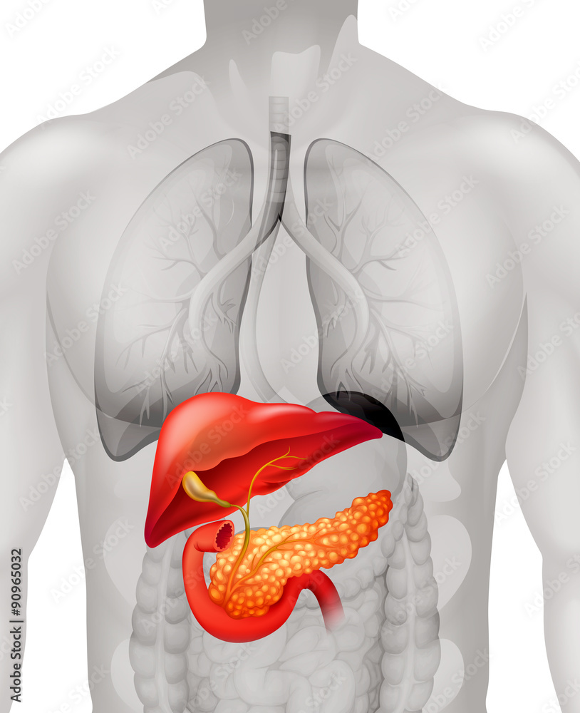 Human Pancreas With Cancer