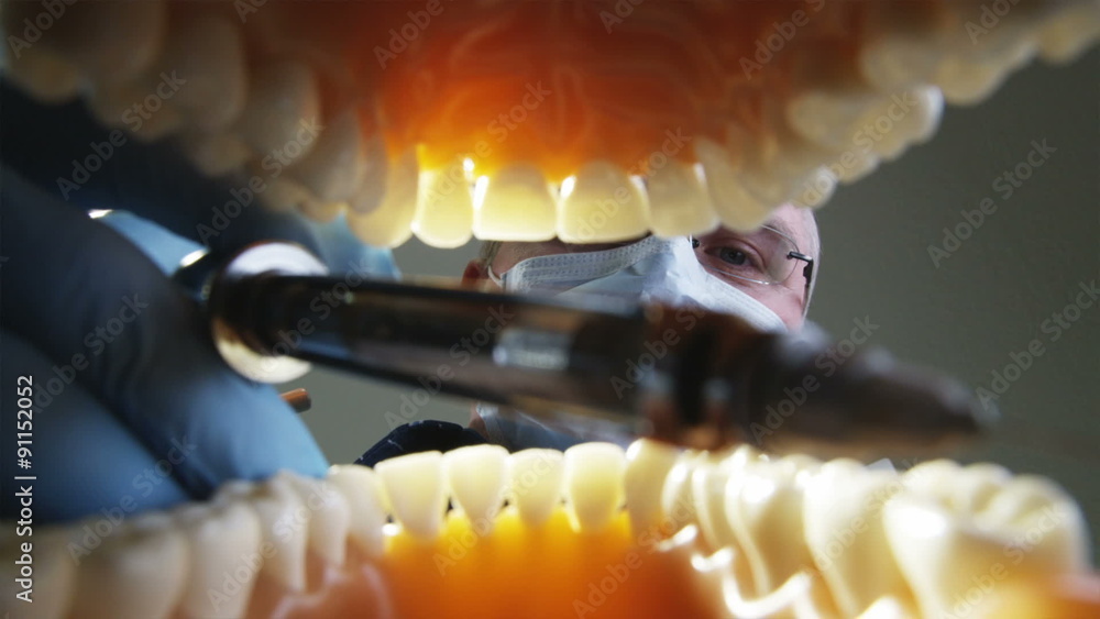 view from inside an open mouth getting a shot of novocaine Stock Video ...