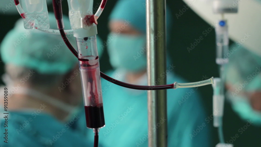 Surgery,blood dripping in focus during surgical operation. Drops of ...