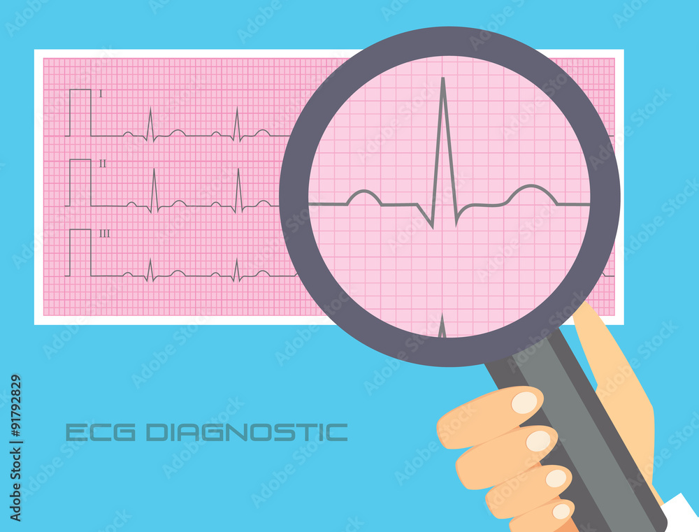 Vetor de Normal ECG vector illustration. ECG interpretation conceptual ...