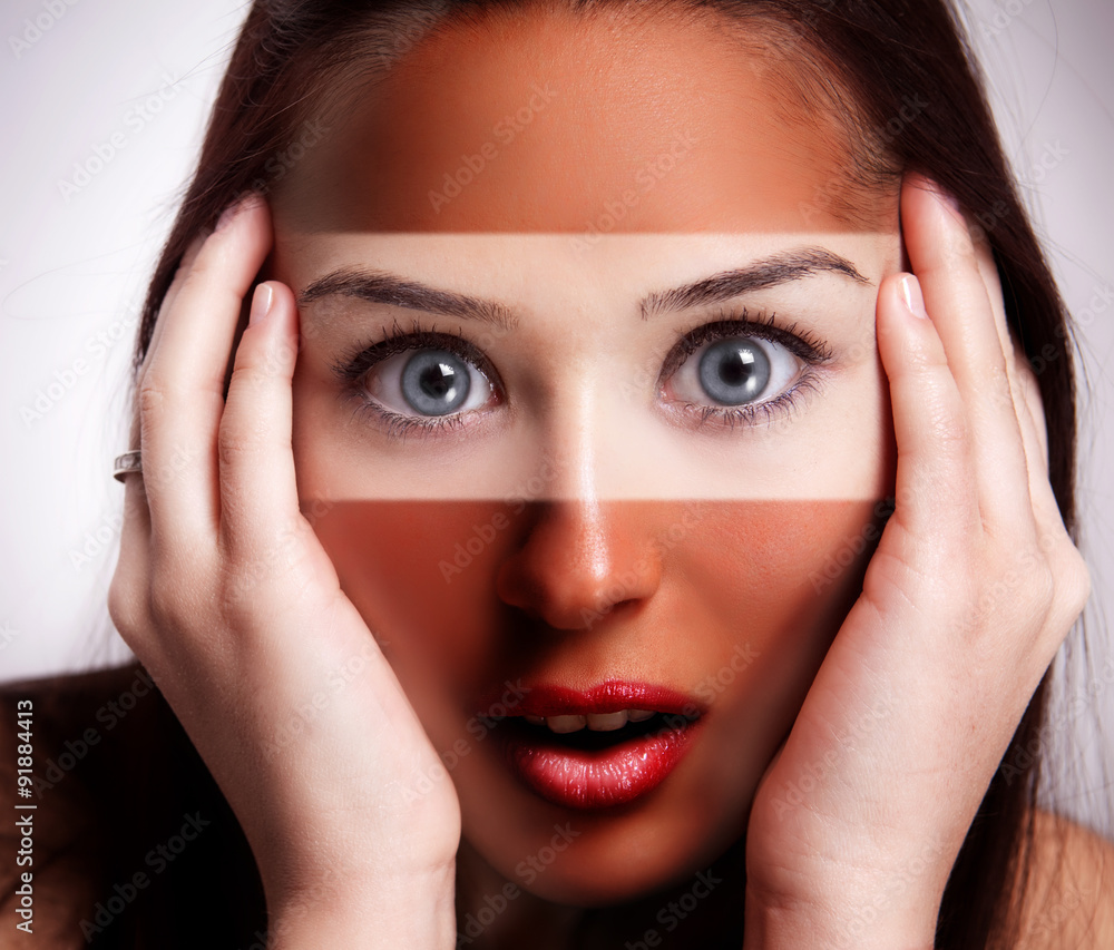 Sunburn concept - woman with tan over half of face Stock Photo | Adobe ...