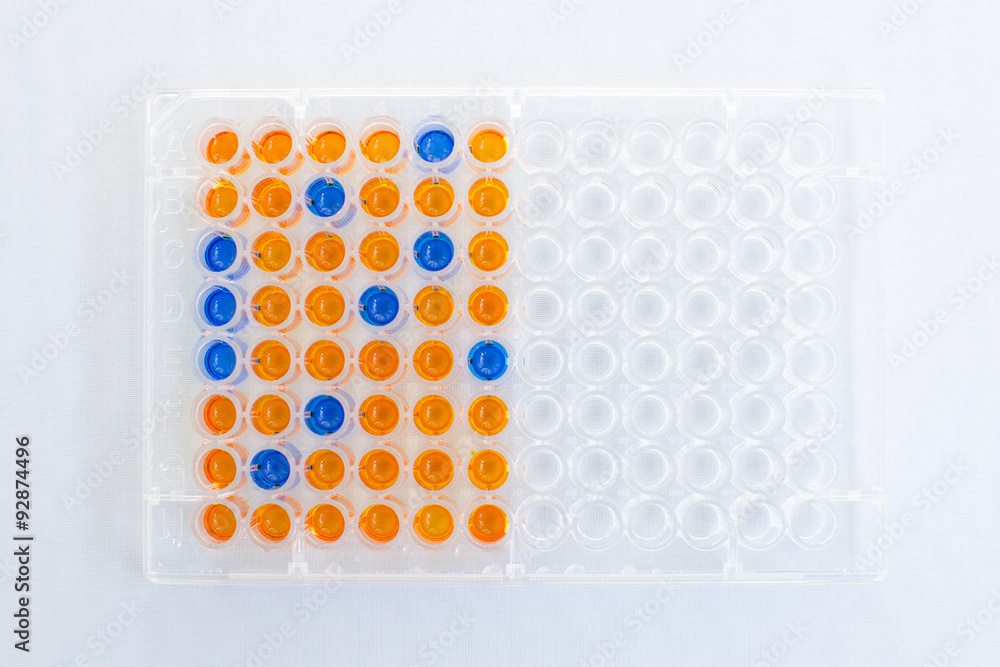 Enzyme-linked immunosorbent assay (ELISA), Immunology testing method in ...
