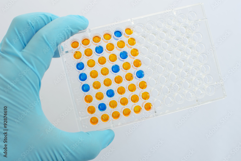 Enzyme-linked immunosorbent assay (ELISA), Immunology testing method in ...