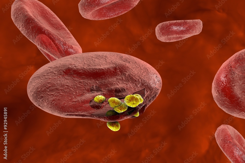 Malaria. Release of malaria parasites from red blood cell Stock ...
