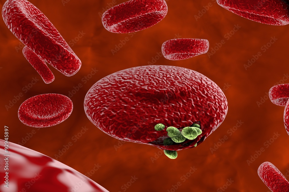 Malaria. Release of malaria parasites from red blood cell ilustración ...