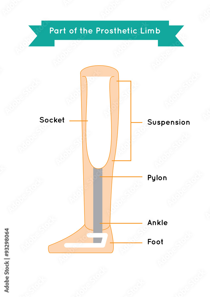 part of Lower Limb Prosthetics infographic vector Stock Vector | Adobe ...