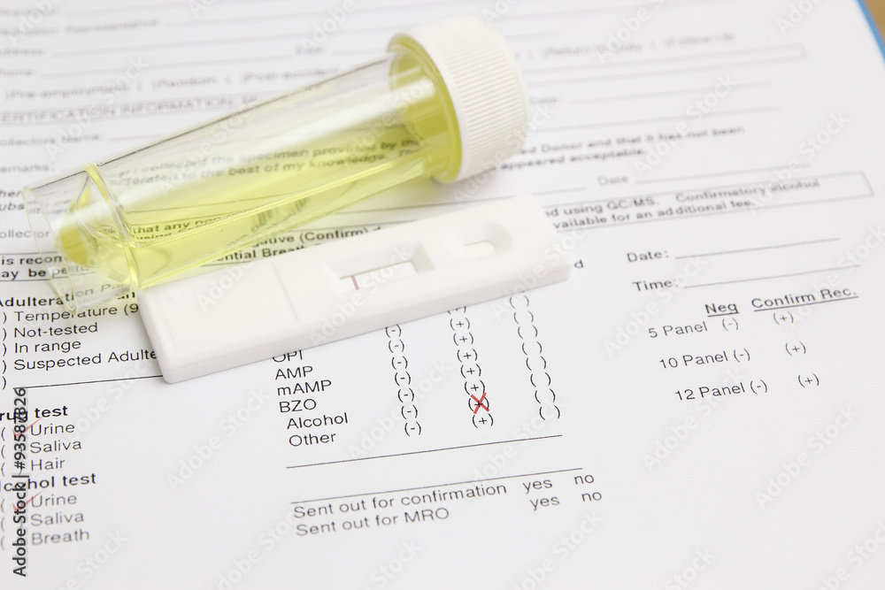 Drug test blank form with test kit and urine,focus on paper Stock Photo ...