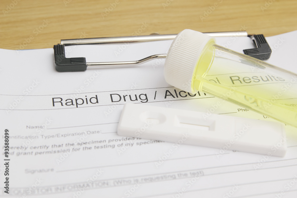 Drug test blank form with test kit and urine,focus on paper Stock Photo ...