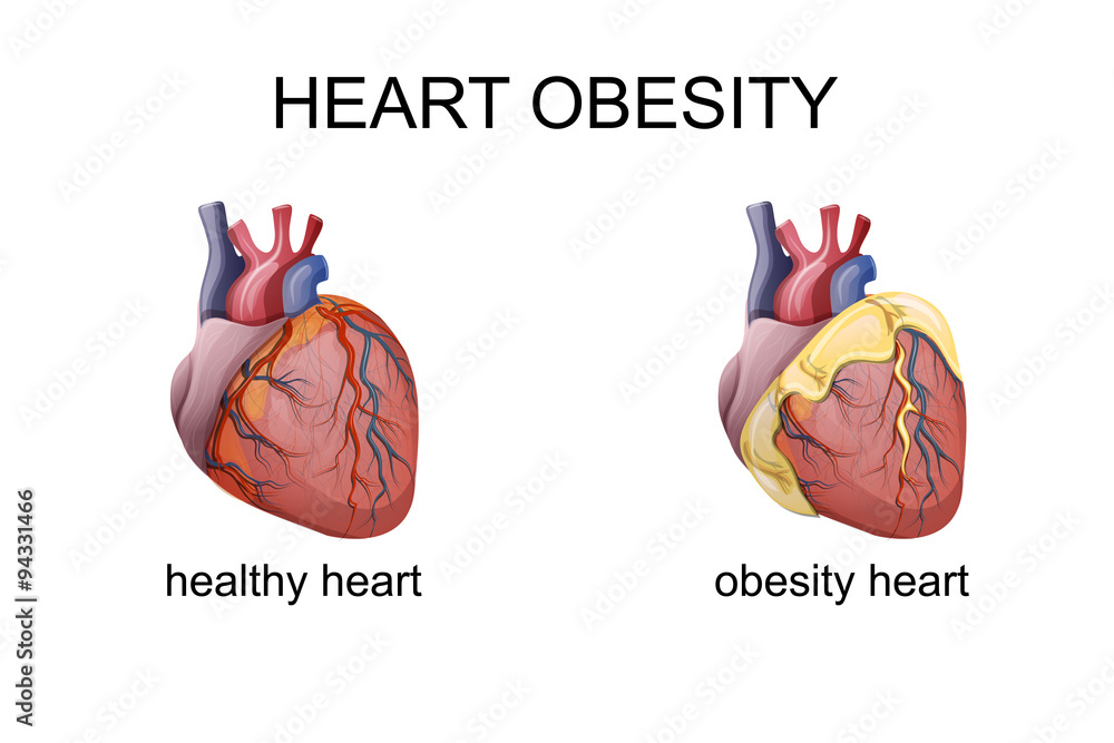 Healthy Heart Vs Unhealthy Heart