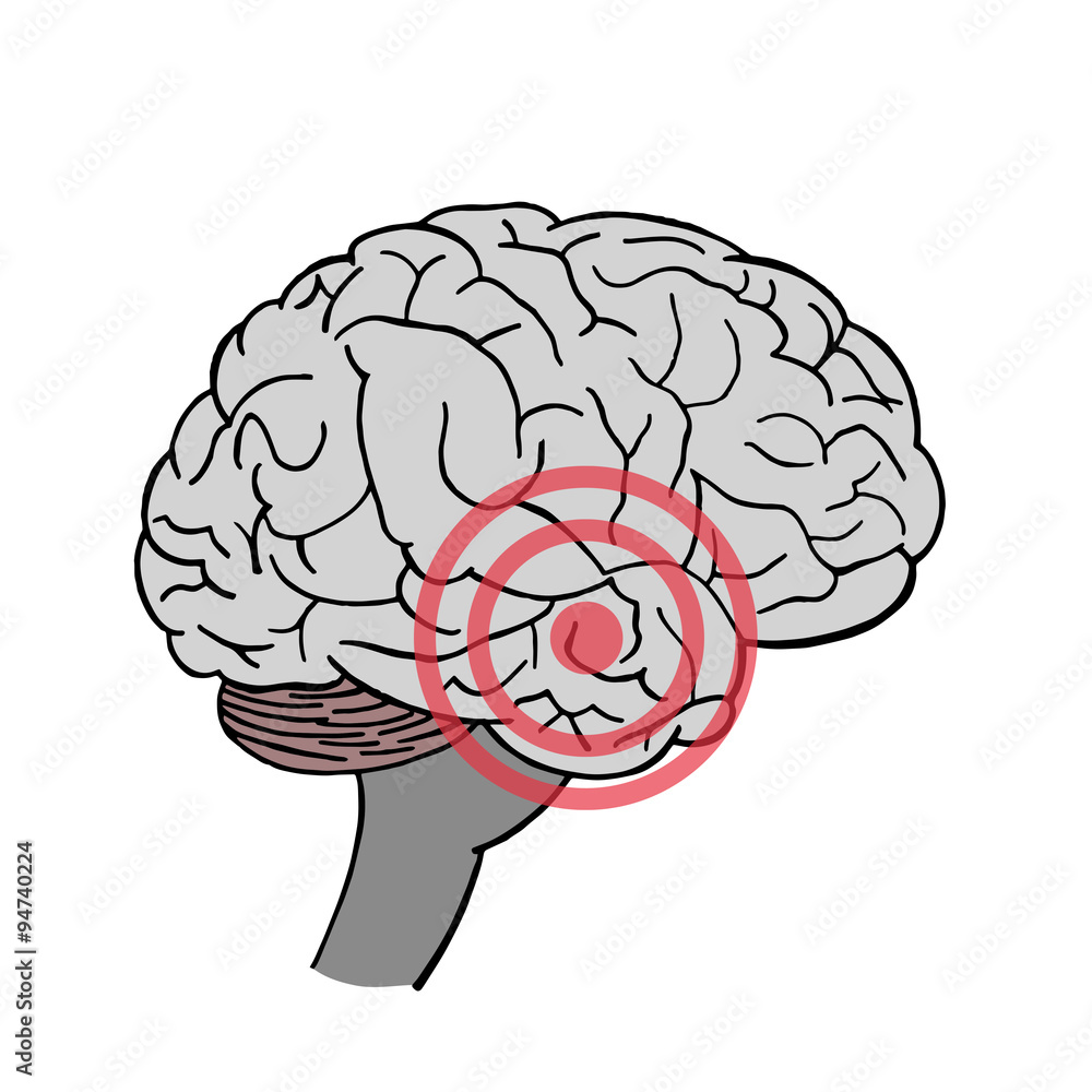 Brain in vector. Headache. Place of pain in brain. Stock Illustration ...