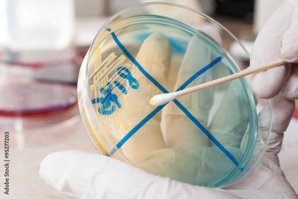 Laboratory doctor hands with sterile gloves holding sterile swab on ...