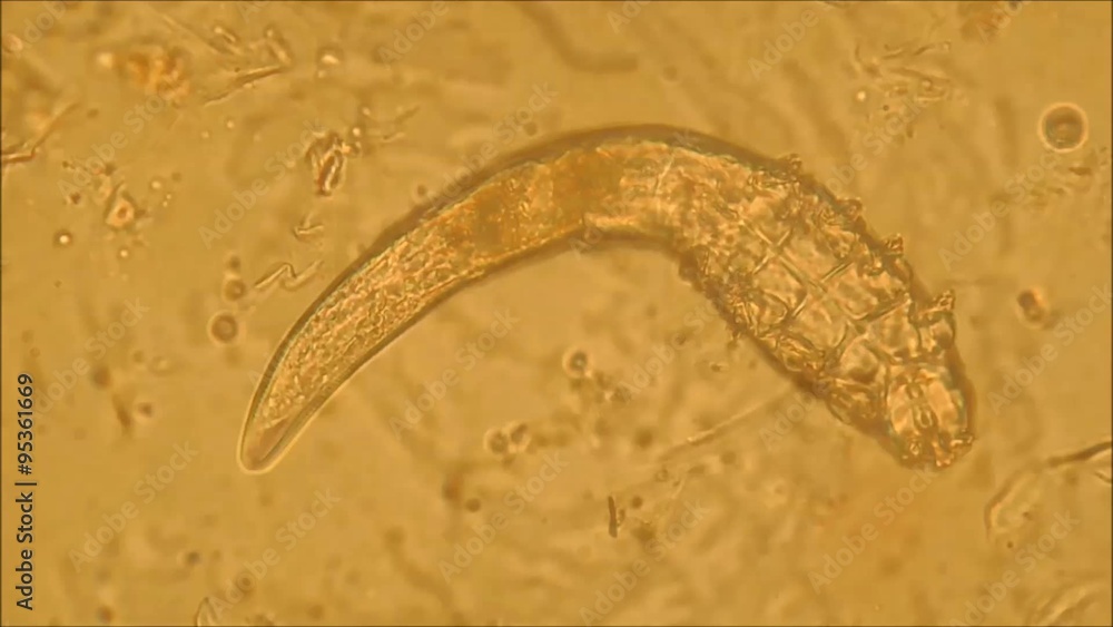 subcutaneous mite Demodex canis under a microscope of 600 times ...