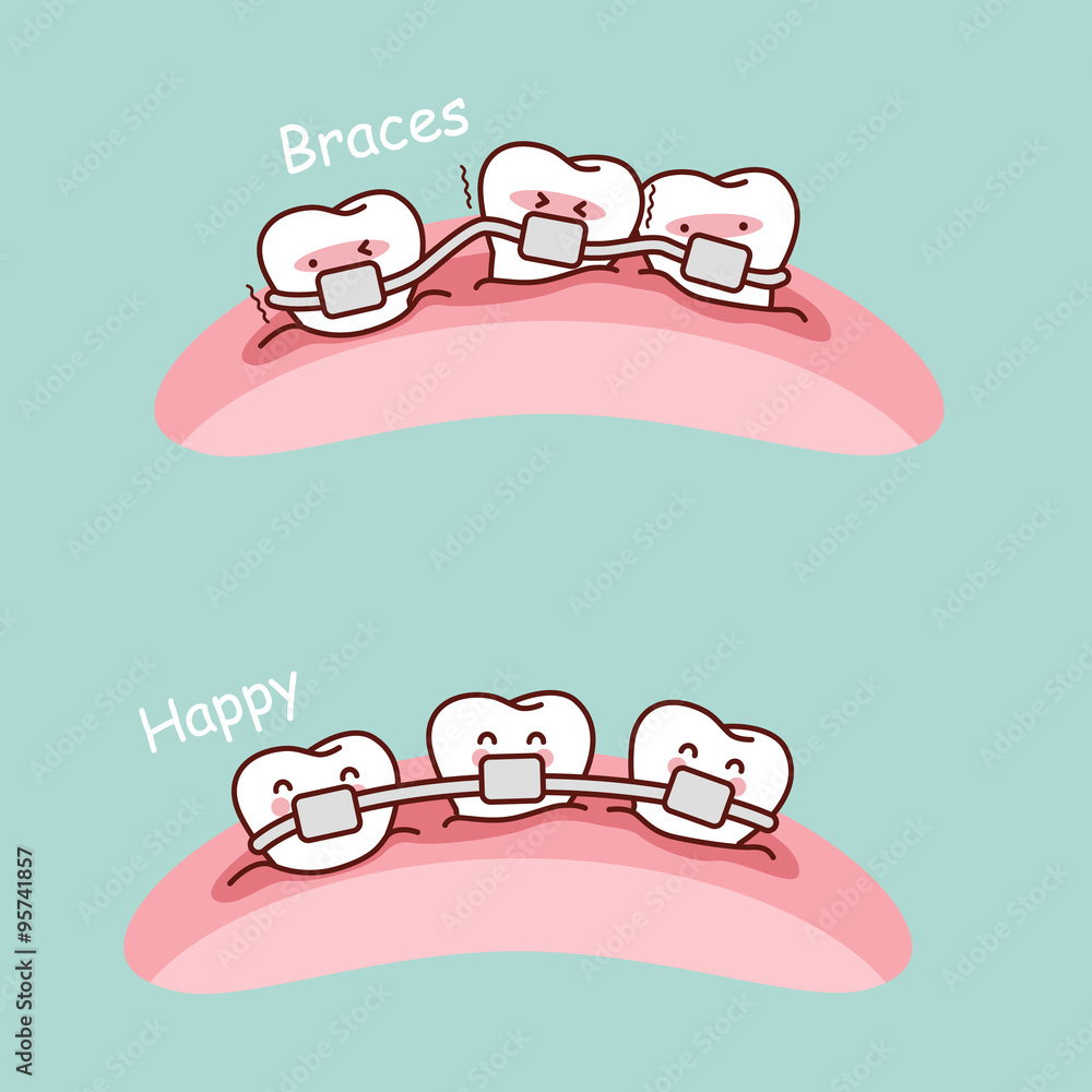 cute cartoon tooth braces Stock Vector | Adobe Stock