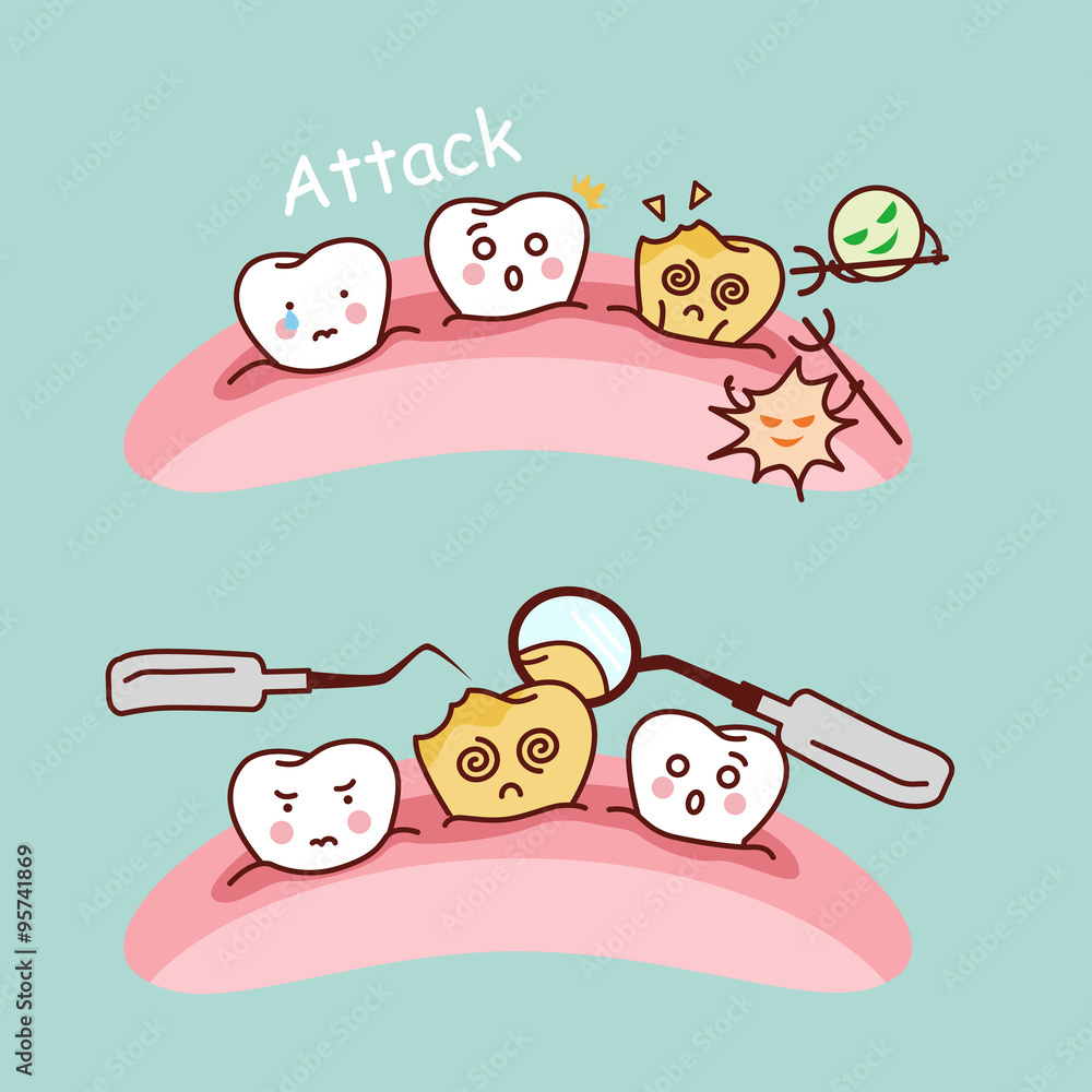 cute cartoon tooth cavity Stock Vector | Adobe Stock