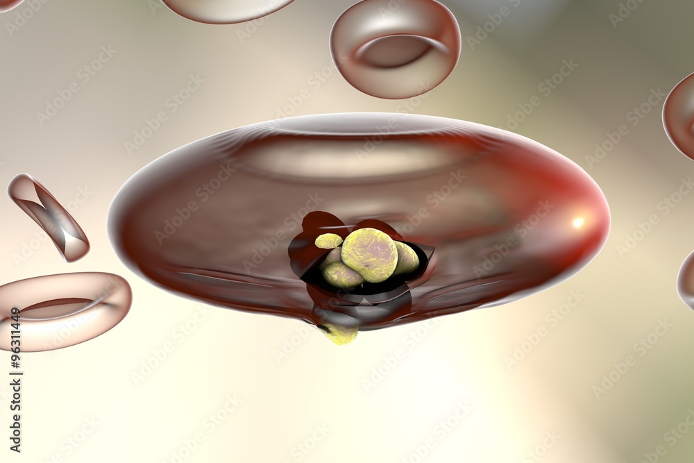 Malaria. Release of malaria parasites from red blood cell. Merozoites ...