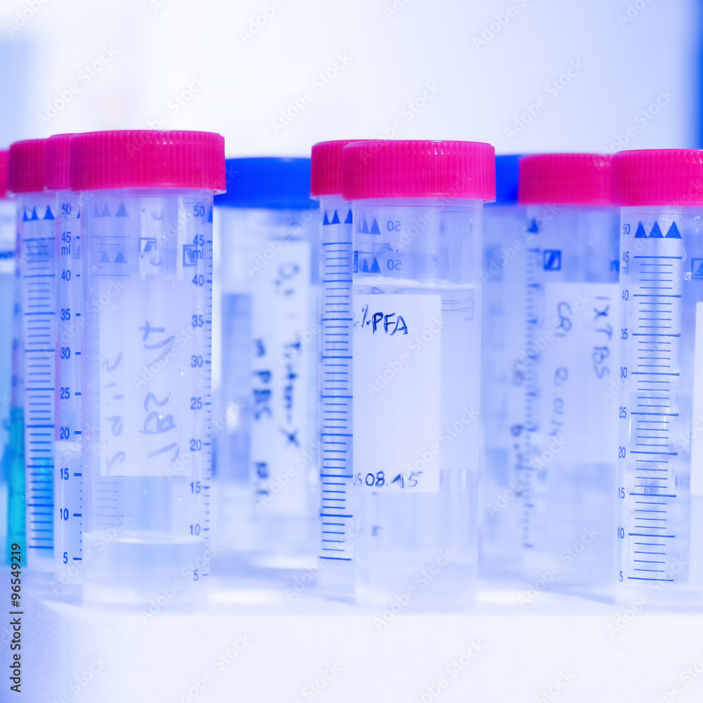 Foto Stock Auswertung Proben | Adobe Stock