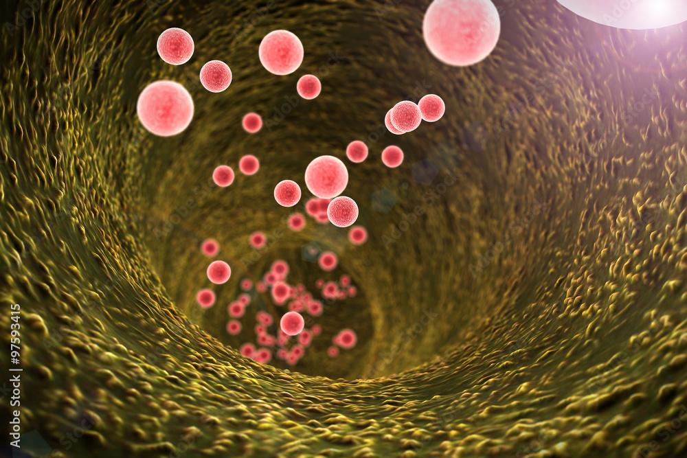 inside of the esophagus, inside the blood vessel, white blood cells ...