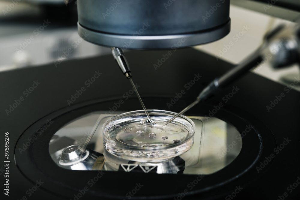 microscope for in vitro fertilization process close up. Equipment on ...
