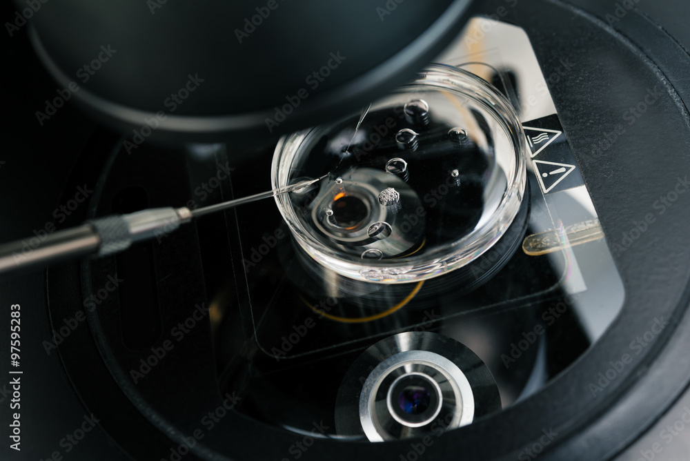 microscope for in vitro fertilization process close up. Equipment on ...