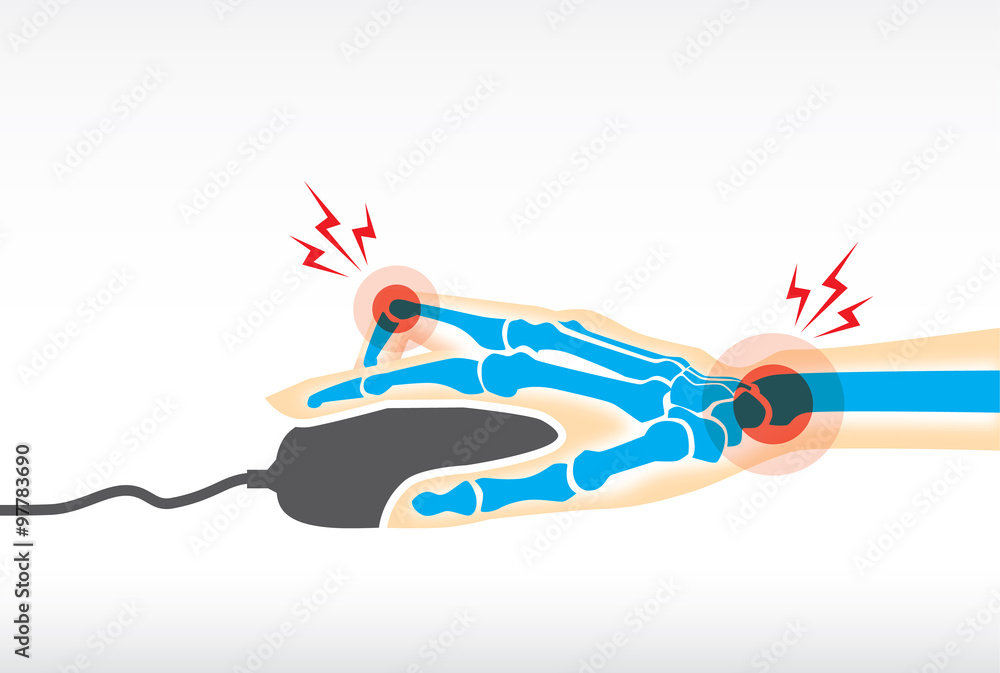 Symptom pain on hand and wrist because used mouse be a long time in ...