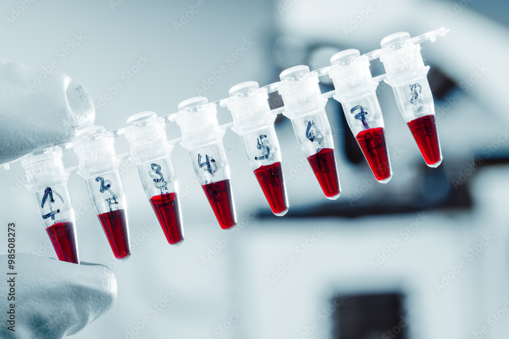 pcr strip and biological microscope Stock Photo | Adobe Stock