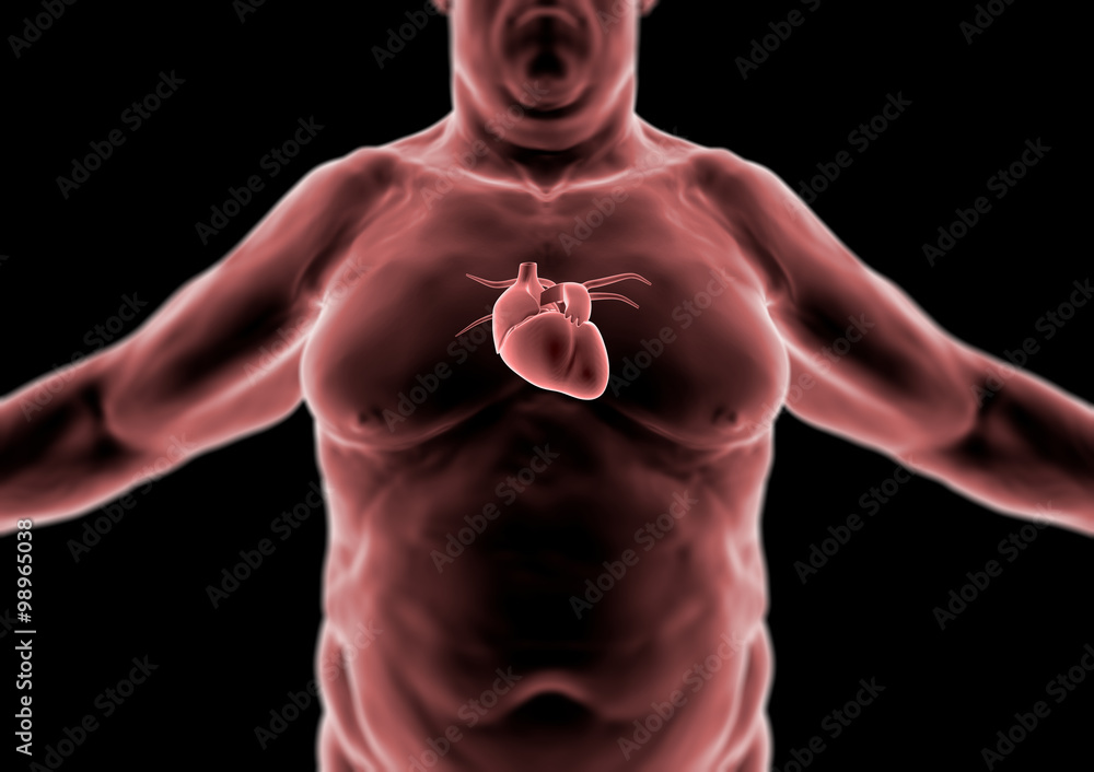 Corpo umano, persona grassa, cuore e anatomia, radiografia Stock ...