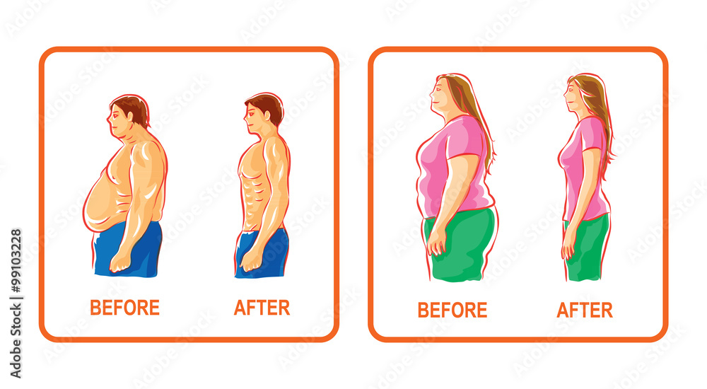 before and after body shape Stock Vector | Adobe Stock