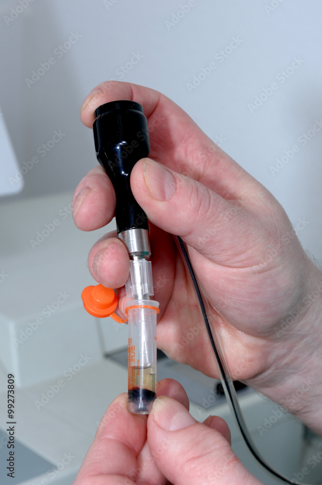 La prise de sang et l’analyse sanguine permettent d’étudier les ...