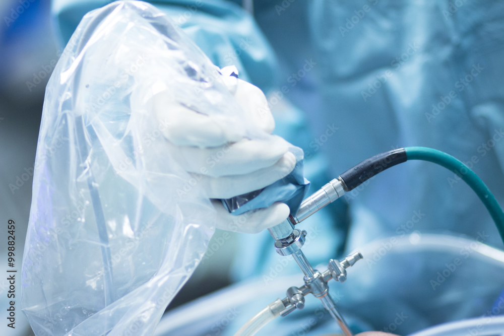 Orthopedic surgery meniscus operation Stock Photo | Adobe Stock