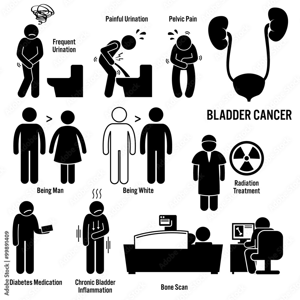 Bladder Cancer Symptoms Causes Risk Factors Diagnosis Stick Figure ...