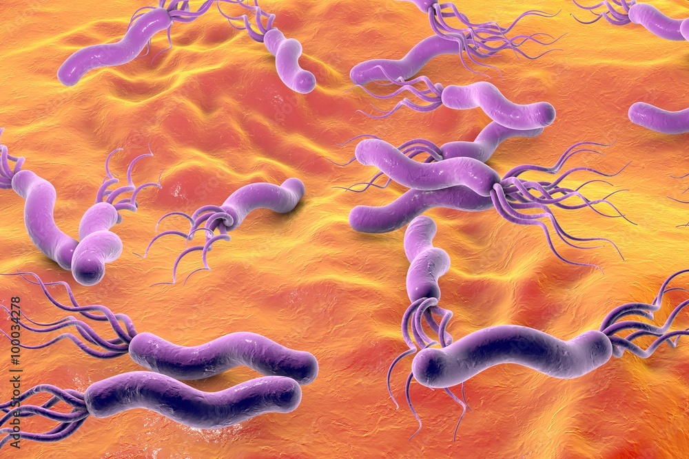 Digital illustration of Helicobacter pylori, bacterium which causes ...
